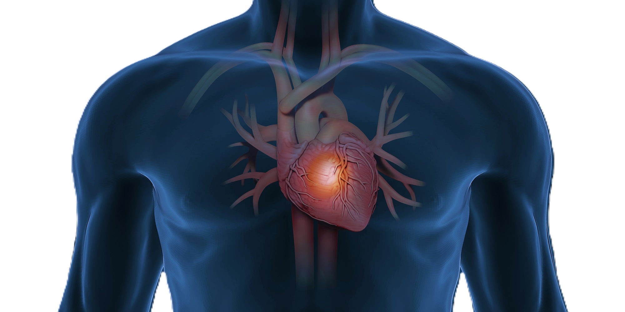 Advanced Treatments in Our Structural Heart Program