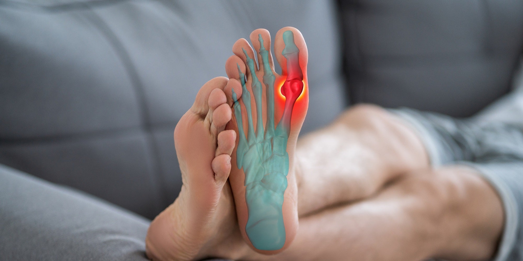 Hallux Rigidus: When to Consider Surgery